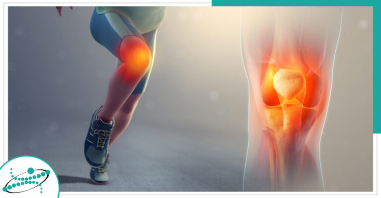 Lesiones de Rodilla - Dr. Esteban Garcés - Traumatólogo Quito ...